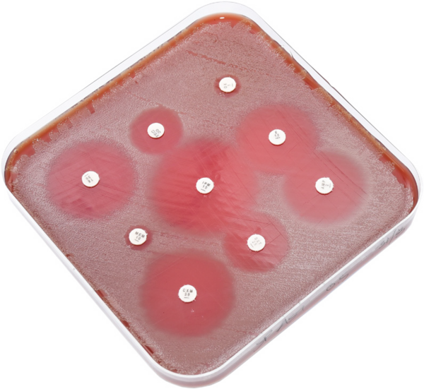 Defibrinated horse blood | International Medical Products